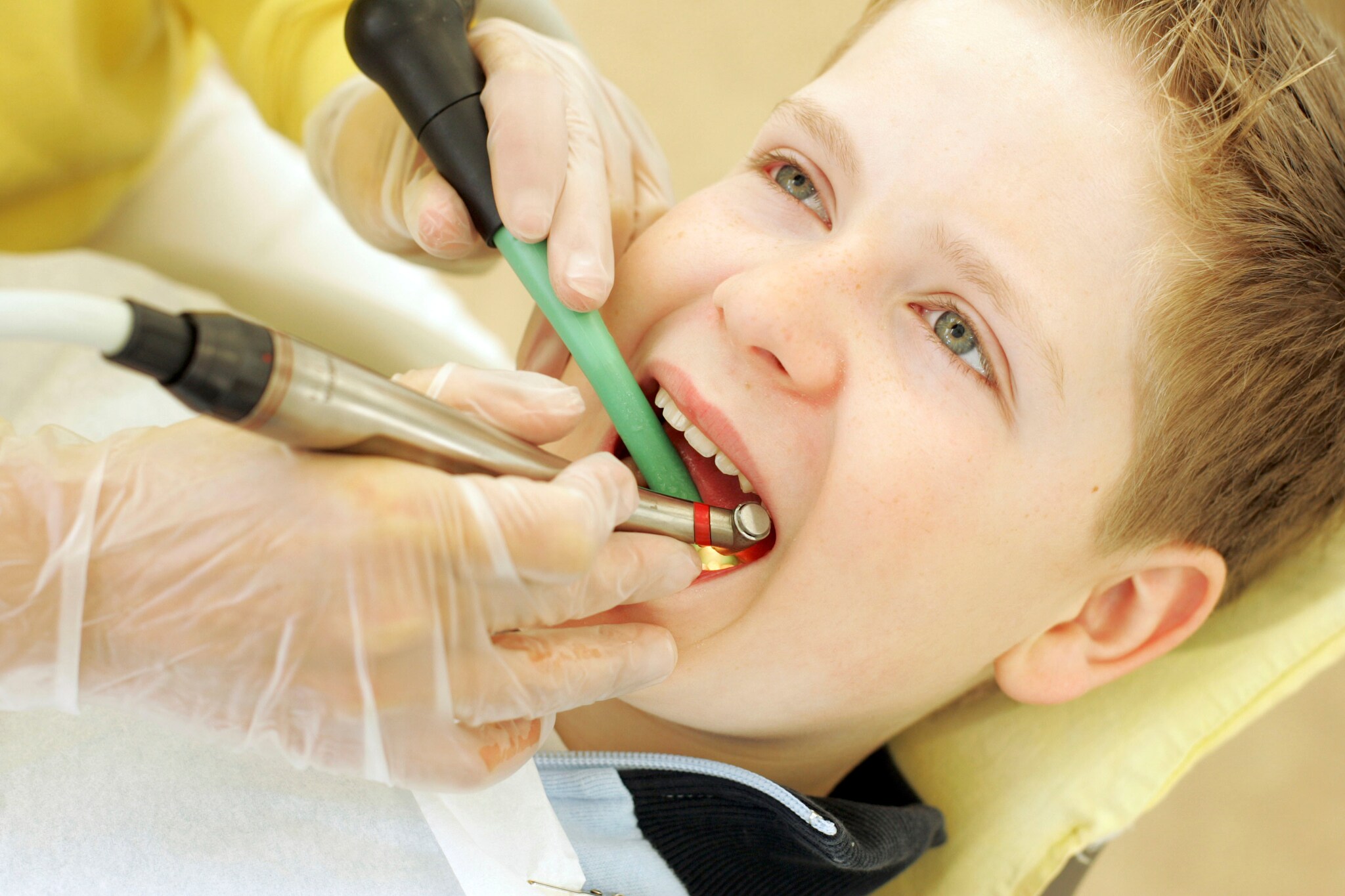 Slecht gebit? Strenge ouders!