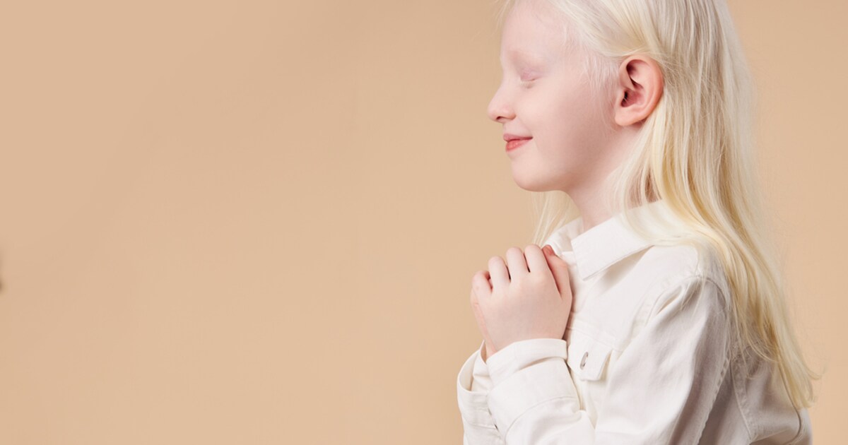 Wereld albinisme dag: wat is albinisme?