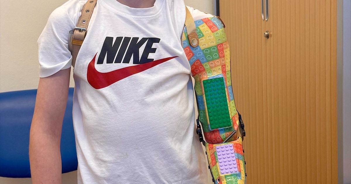 Tobi (8) heeft prothese-arm van LEGO-blokjes - Kidsweek